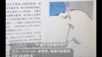 张令颈肩腰腿痛六骶管注射 常用定位