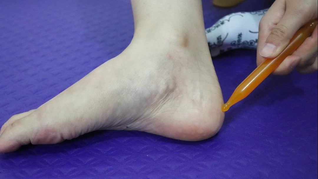 痔疮疼痛难忍,按摩脚跟3分钟,刮走砂粒,专克痔疮,直肠轻松!