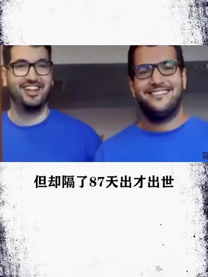 世界上最长的双胞胎间隔,刷记录了