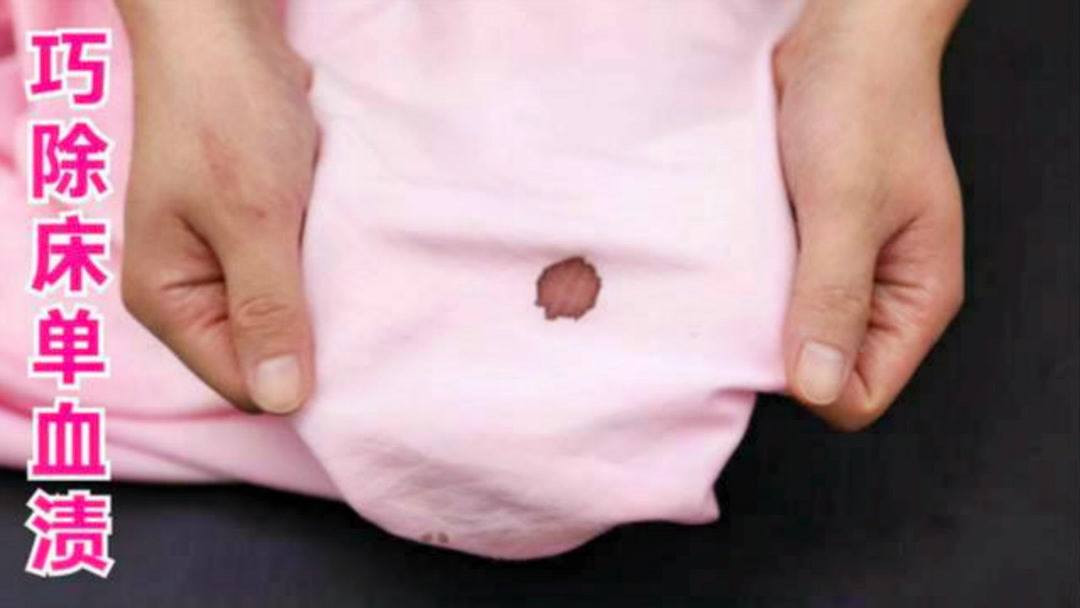 床单上有血渍不用愁,教你一招,多久的血渍都能轻松去除,快学学