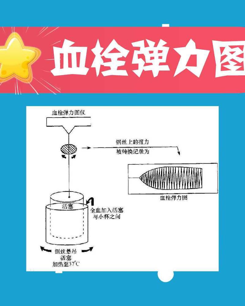 血栓弹力图:血栓弹力仪描绘出的特殊图形