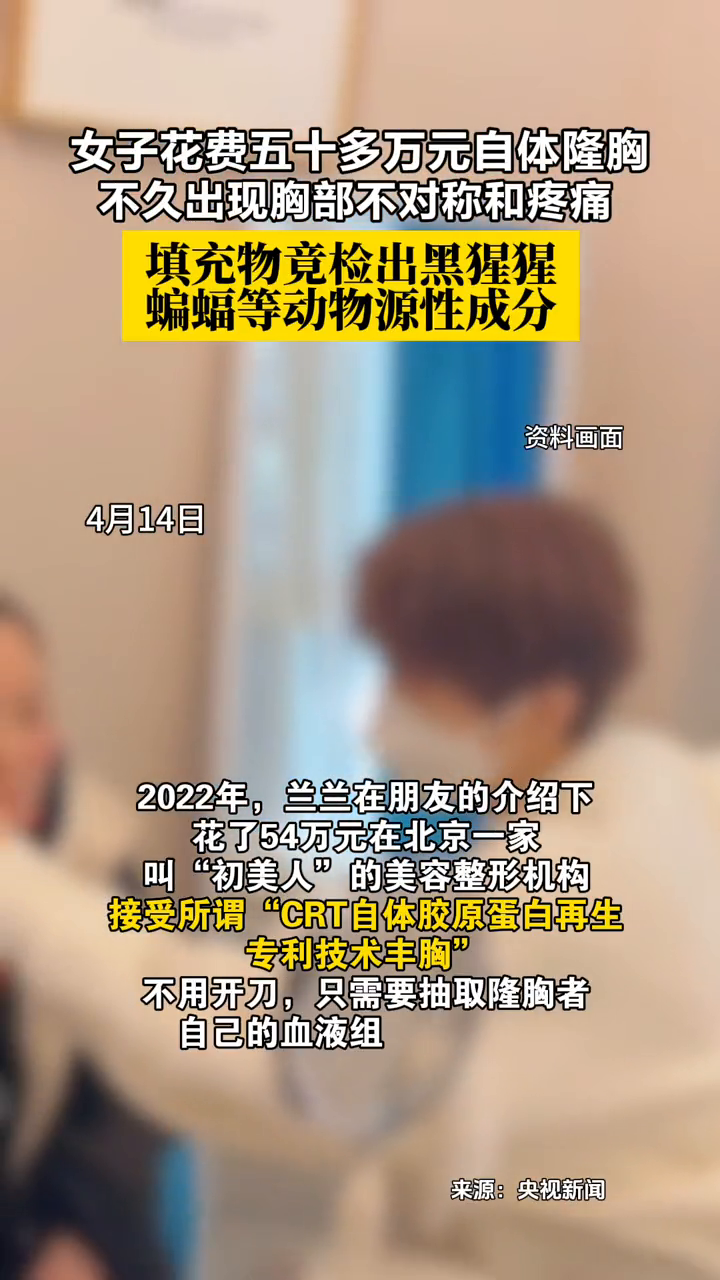 女子花费五十万元自体隆胸不久出现胸部不对称和疼痛
