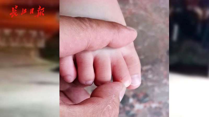 2岁半幼儿被毒蛇咬伤来汉求医,民警25分钟狂奔40公里
