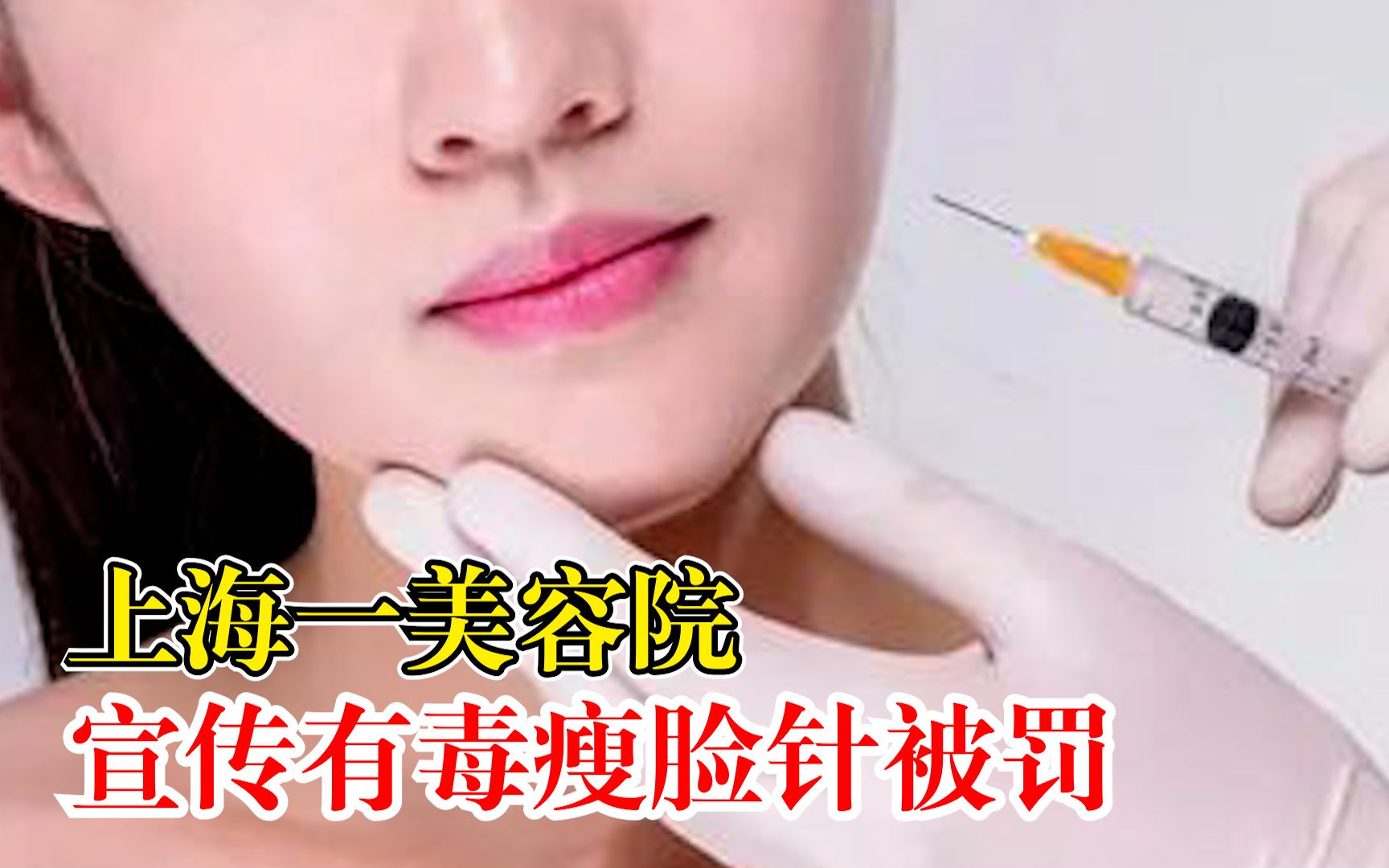 上海一美容院宣传有毒瘦脸针被罚:为注射用A型肉毒毒素