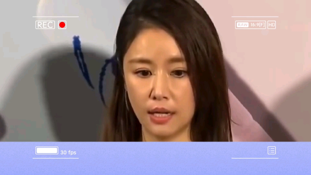 林志颖受伤暂不修复面部?首次手术5小时完成,旧爱林心如夸对方有福报