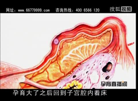 输卵管性不孕的类型【输卵管】