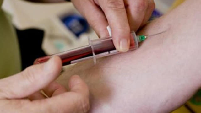 熊猫血还不是最稀有的血型,而是这三种?看完大开眼界!