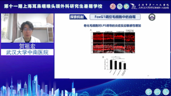 自噬通路在内耳毛细胞老化和凋亡过程中的作用机制
