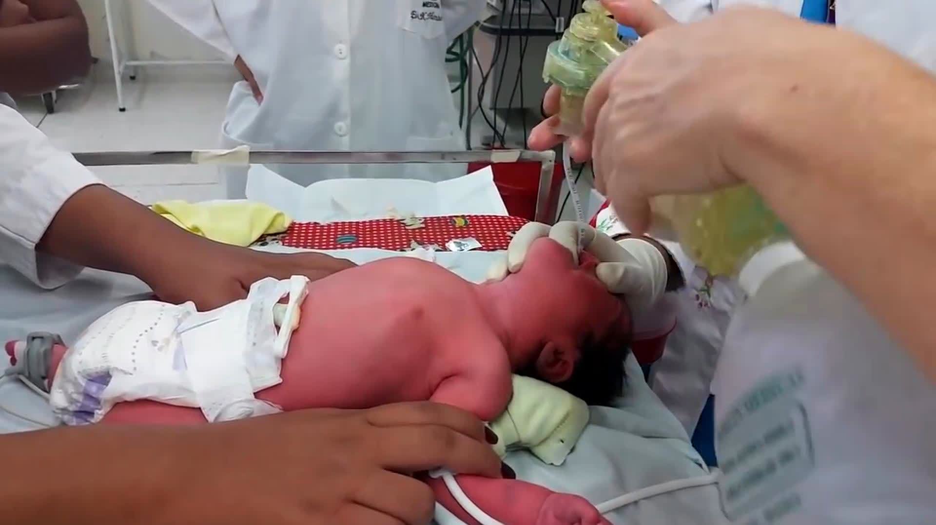 医生给新生婴儿插管,宝宝全程一声不吭,却让人心疼到想哭
