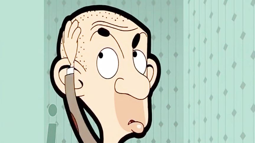 憨豆先生动画版:还是要头发好,憨豆的头跟没毛的鸡一样