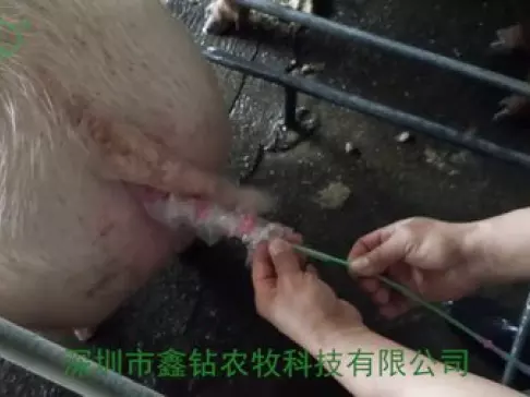 西班牙LTC深部输精管操作视频
