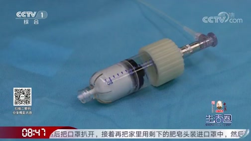 [生活圈]专家解答 经皮椎体成形术有哪些优势?