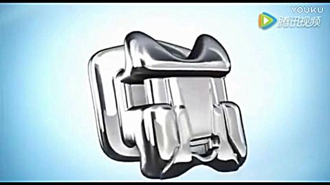 牙齿正畸的过程,看完这个视频全懂了_高清