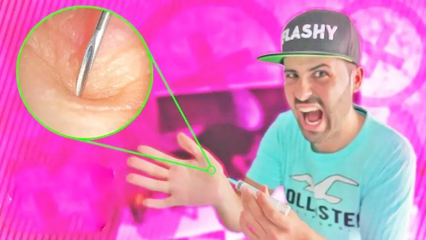 老外用显微镜观看针刺破皮肤,这么爱作死,不如让容嬷嬷来扎?