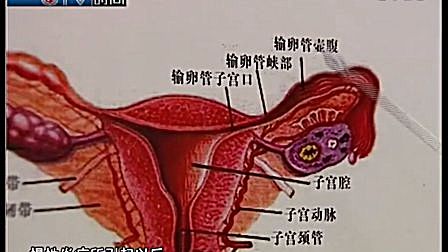 【健康第一】不孕专家文华讲解输卵管性不孕