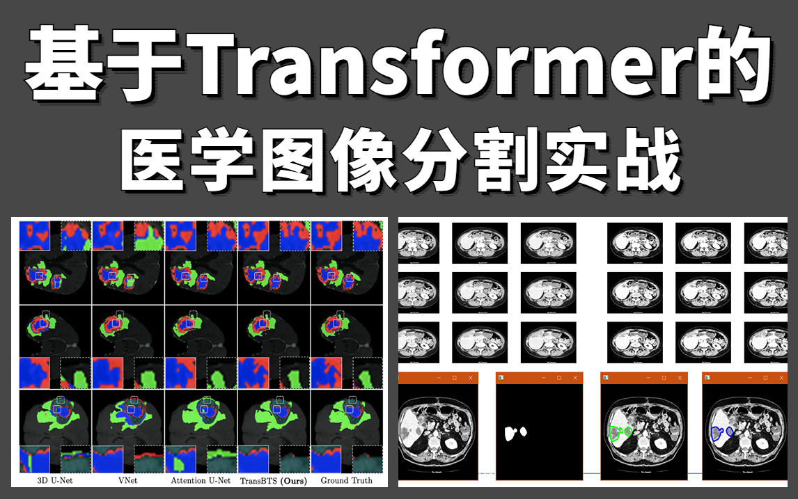 ...Transformer的医学图像分割实战,论文精读+源码复现,看完就能跑通!