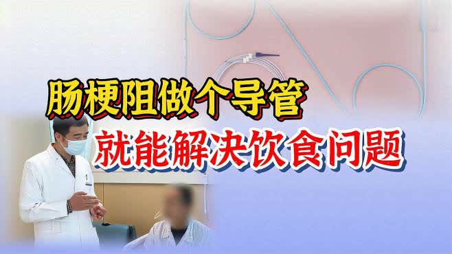 肠梗阻做个导管就能解决饮食问题?