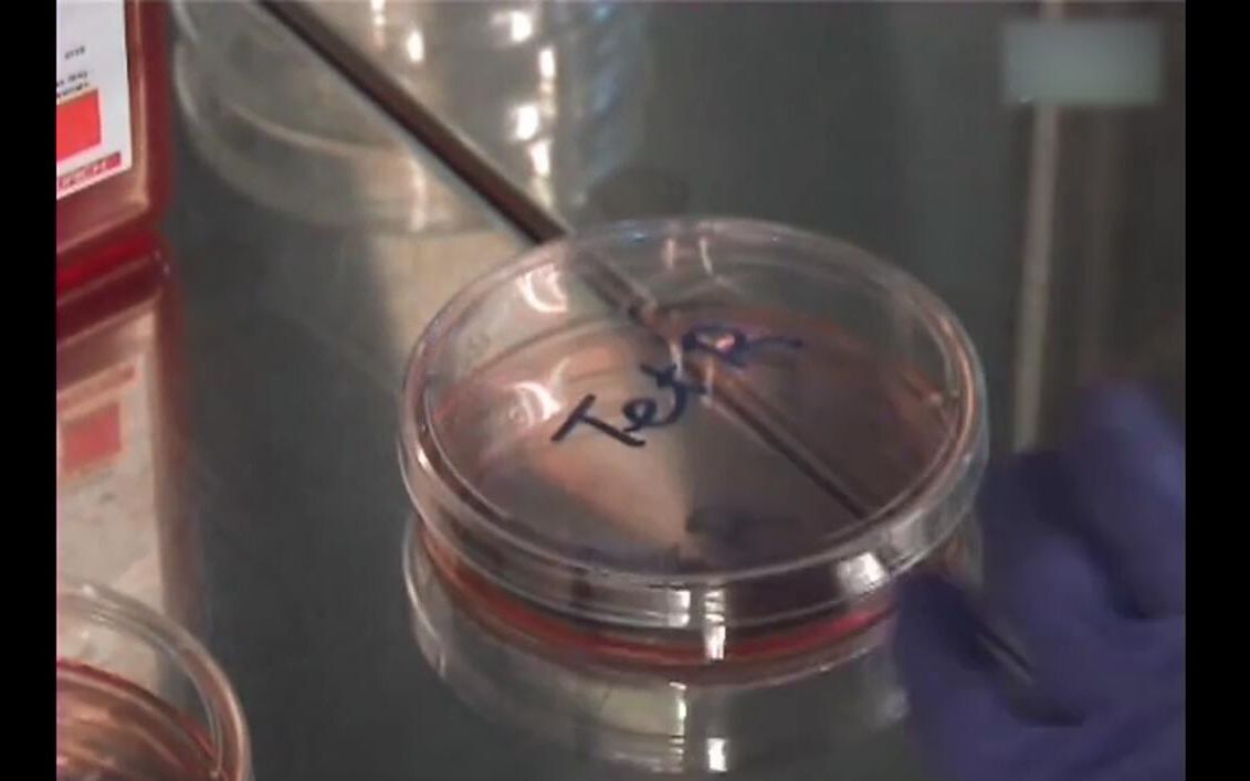 【生物科研视频教程】四环素(Tet-on)诱导shRNA或cDNA表达产生稳定...