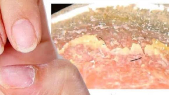 手指甲到底有多脏?显微镜下放大100倍,场面一目了然!