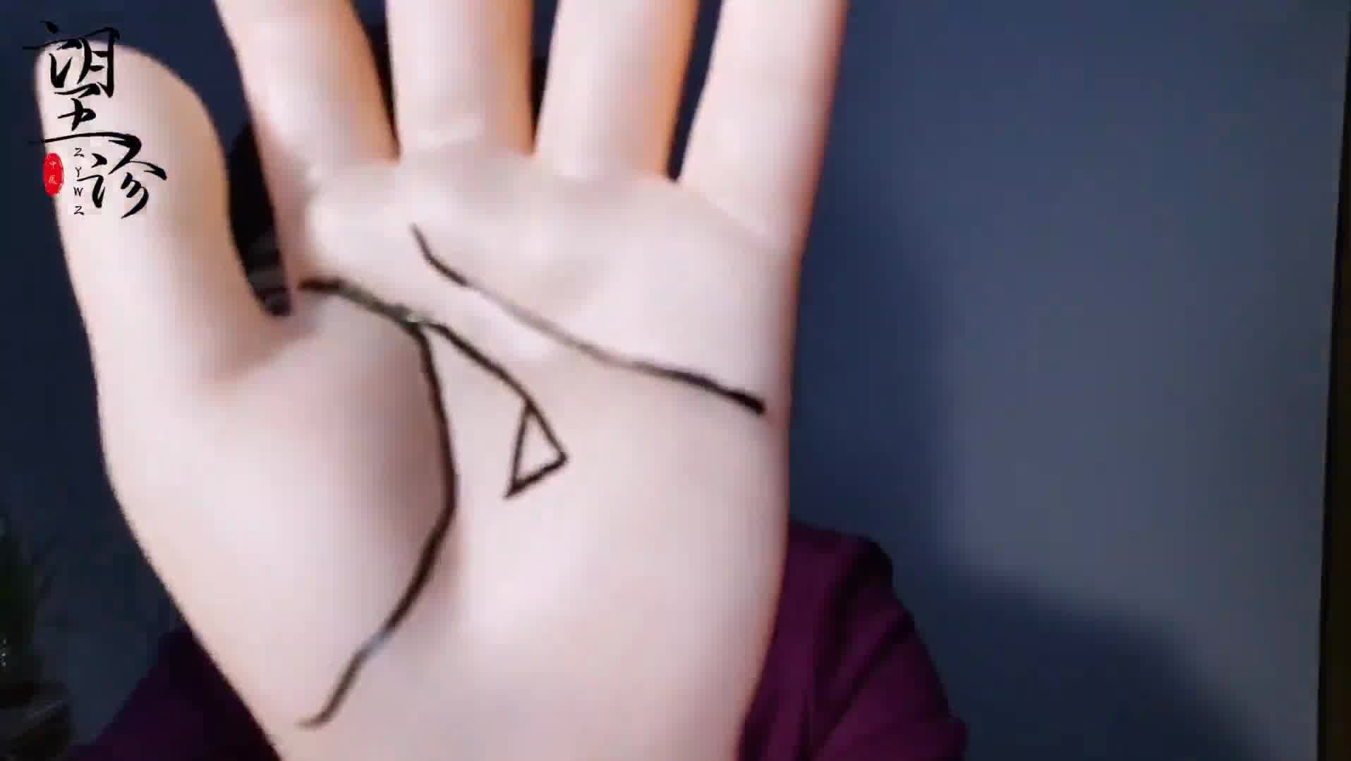 冠状动脉硬化、冠心病在我们手掌上有哪些表现呢?