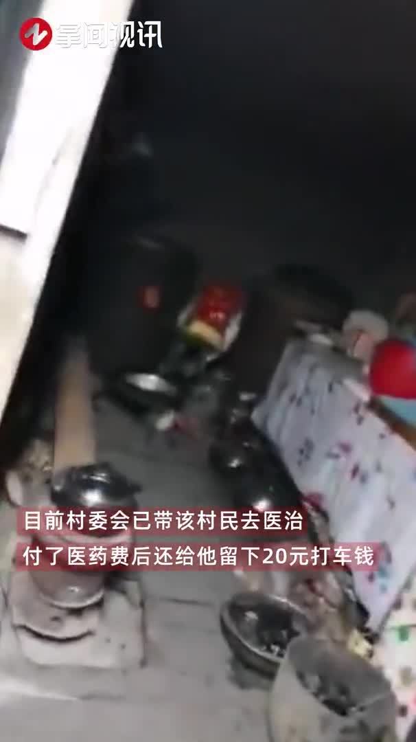 大叔把村里发的消毒酒精当酒喝了:咱们有缘,坐下喝两杯!