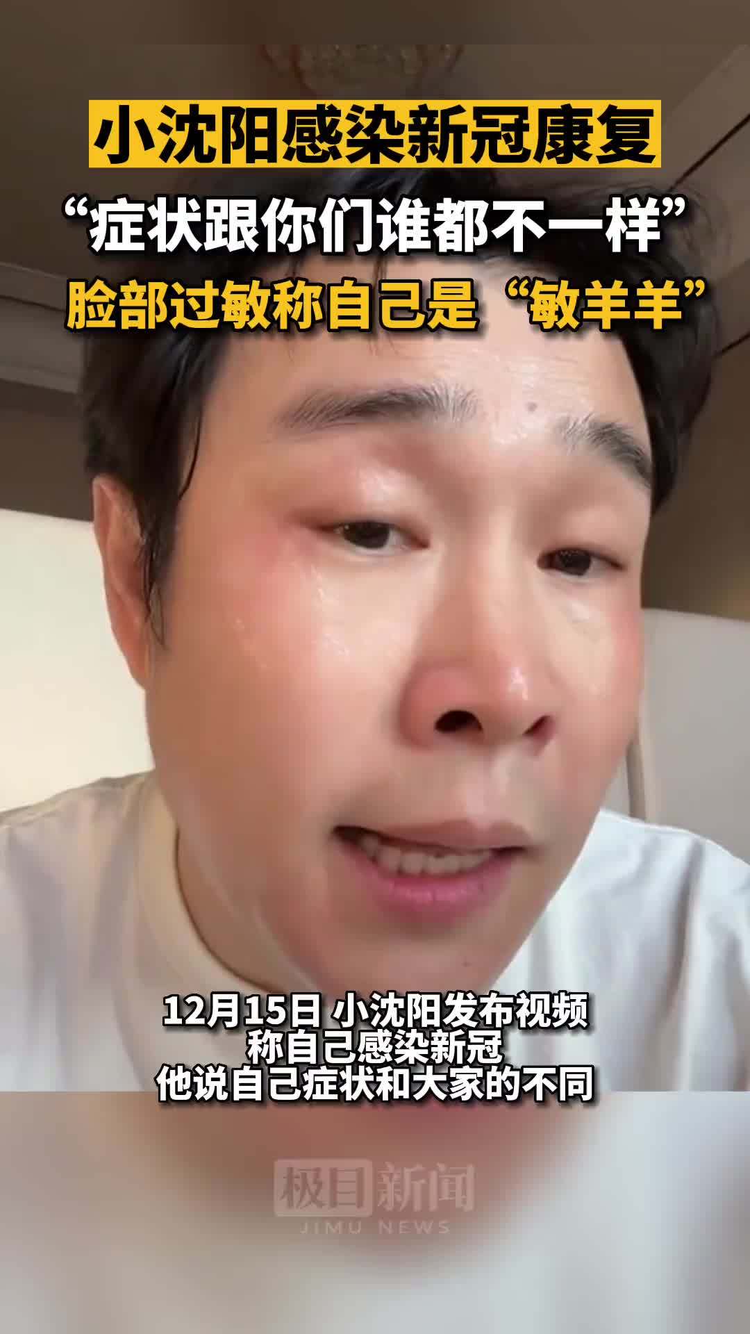 小沈阳感染新冠称自己症状和大家的都不同:哪也不疼,脸疼