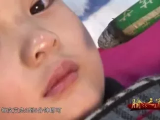 治疗小儿流涎地仓穴