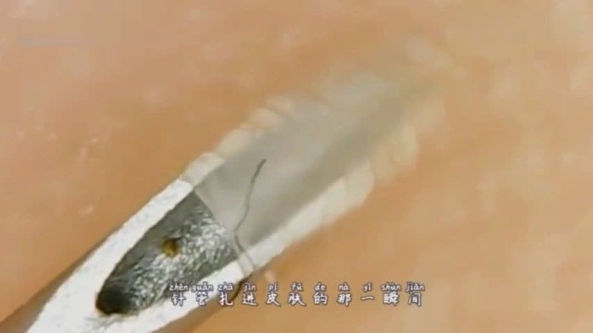 打针到底有多可怕呢?使用高倍率的显微镜观看针头扎进皮肤的模样,...