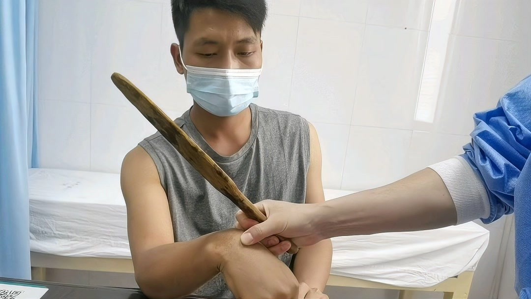 小伙子腱鞘囊肿复发,中医大夫“暴力”处理,这样就不用穿刺了