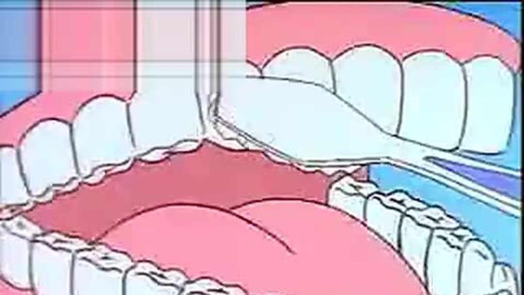 正确的刷牙方法动画版(45度角)