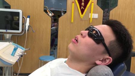 新型吸唾开口胶使用体验