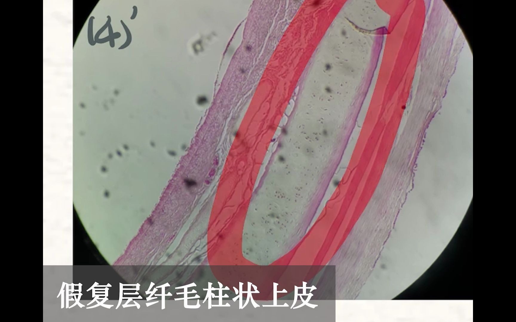 【图解组胚】玻片找一找:气管的导气部和呼吸部,气血屏障,肺泡细胞的...