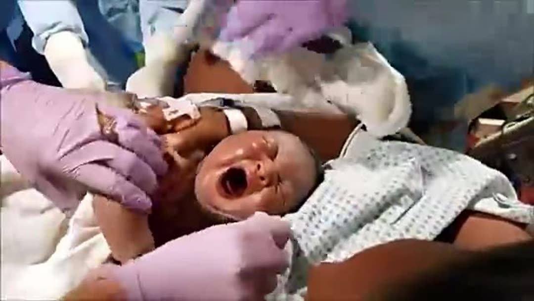 近距离直击孕妇分娩全过程