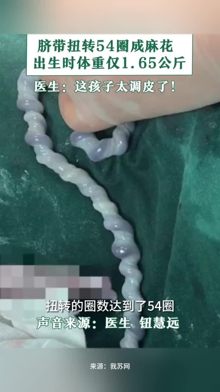 罕见!胎儿脐带扭转54圈拧成麻花