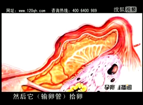 输卵管近端堵塞怎么治疗