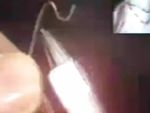 卡环弯制28分钟