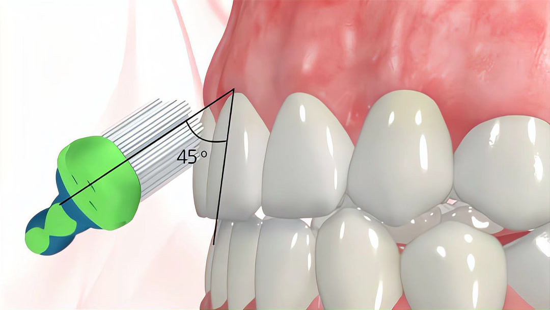 刷牙、电动牙刷、牙线使用教程,带你开启正确的牙齿清洁姿势