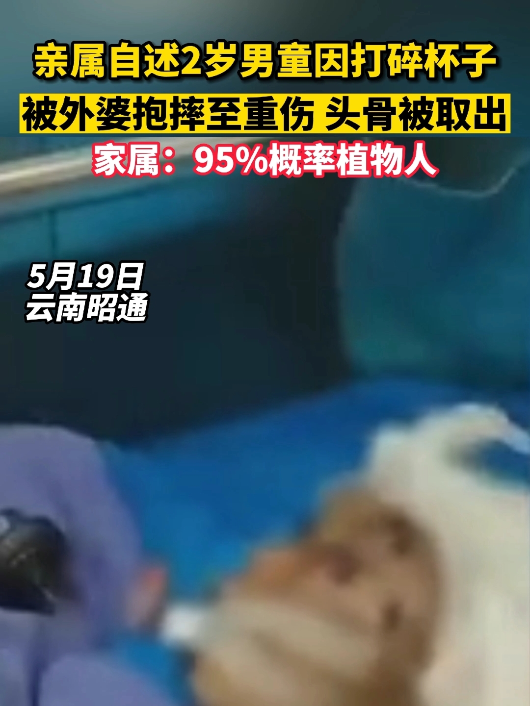 75%概率死亡95%概率植物人