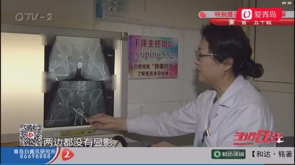 青岛助孕专家于萍:输卵管性不孕,于萍主任帮分析