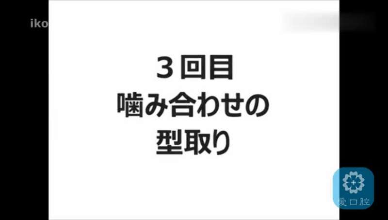 上颌两侧后牙缺失活动义齿制作过程