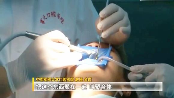 西安:牙齿掉了能再生?医生攻克这世界性难题 让死亡的牙齿复活