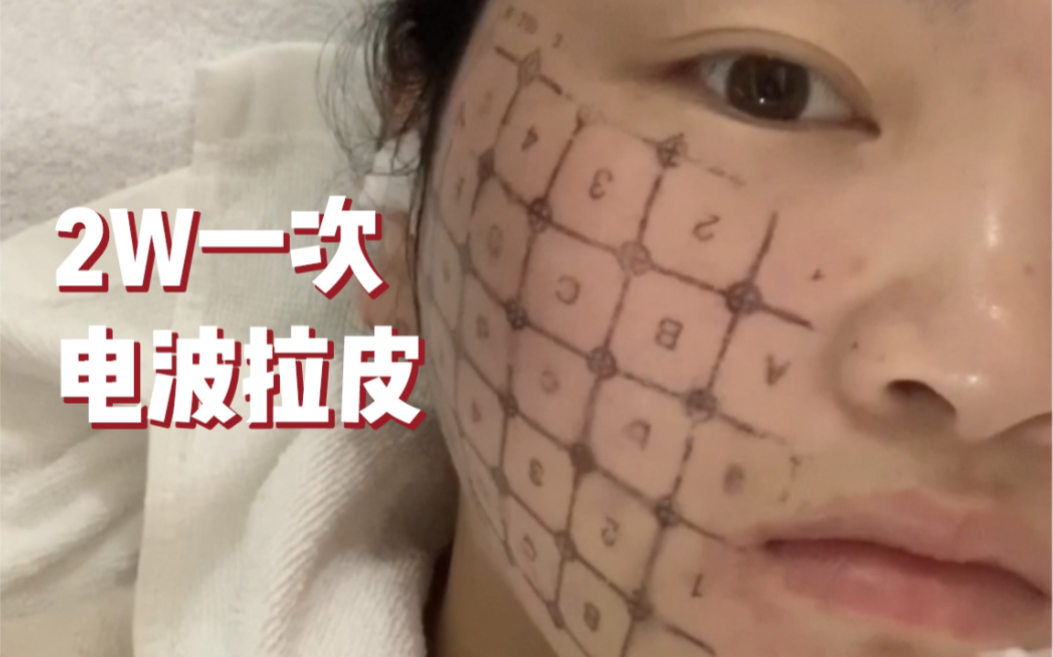 打脸直男癌评论,热玛吉/电波拉皮不是医美邪术!