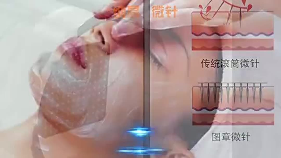 纳晶纳米电动微针美容 微针仪操作视频