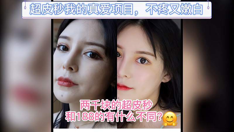 两千块的超皮秒和188块的有什么不同?