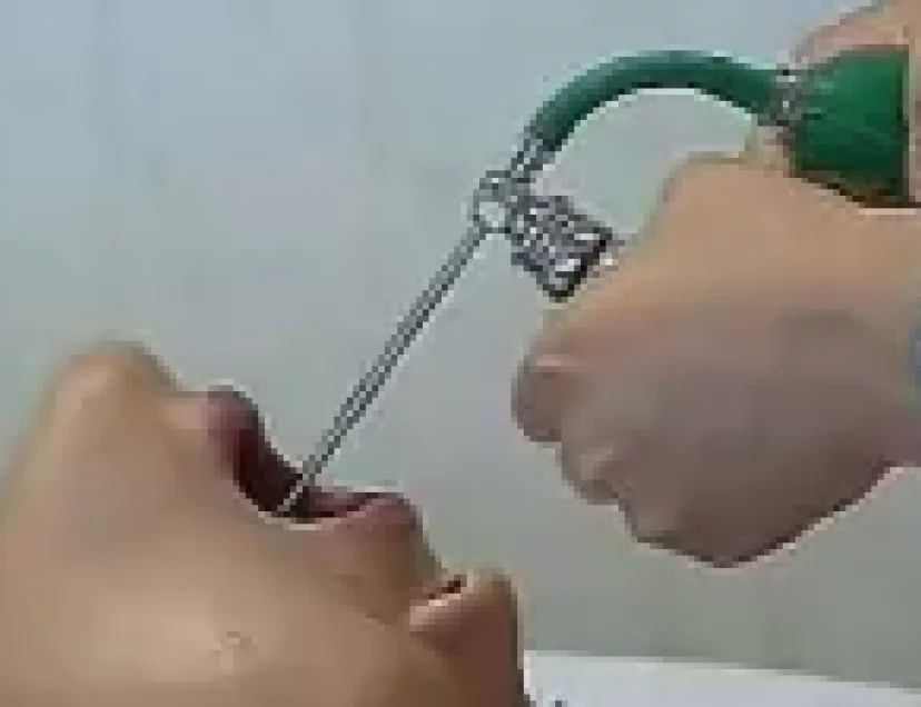 气管插管术(卫生部教材)_标清