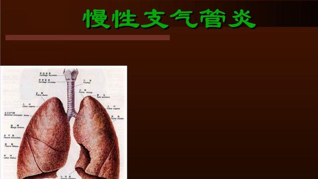 什么是慢性支气管炎?