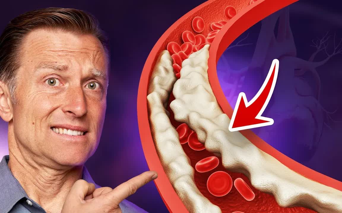 【中英文字幕】被忽视的动脉钙化原因,柏格医生