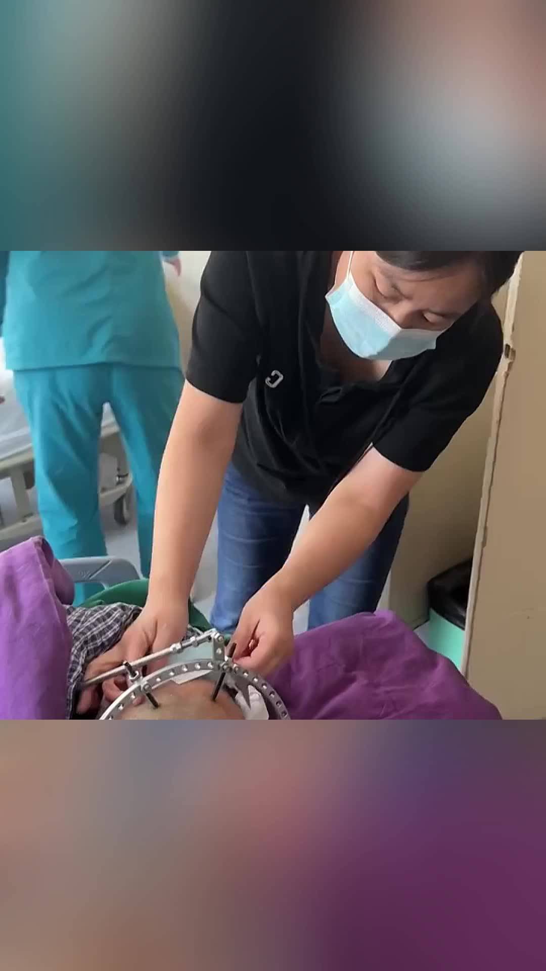 “折叠男孩”姜延琛今早进入手术室,今天开始第二次手术。