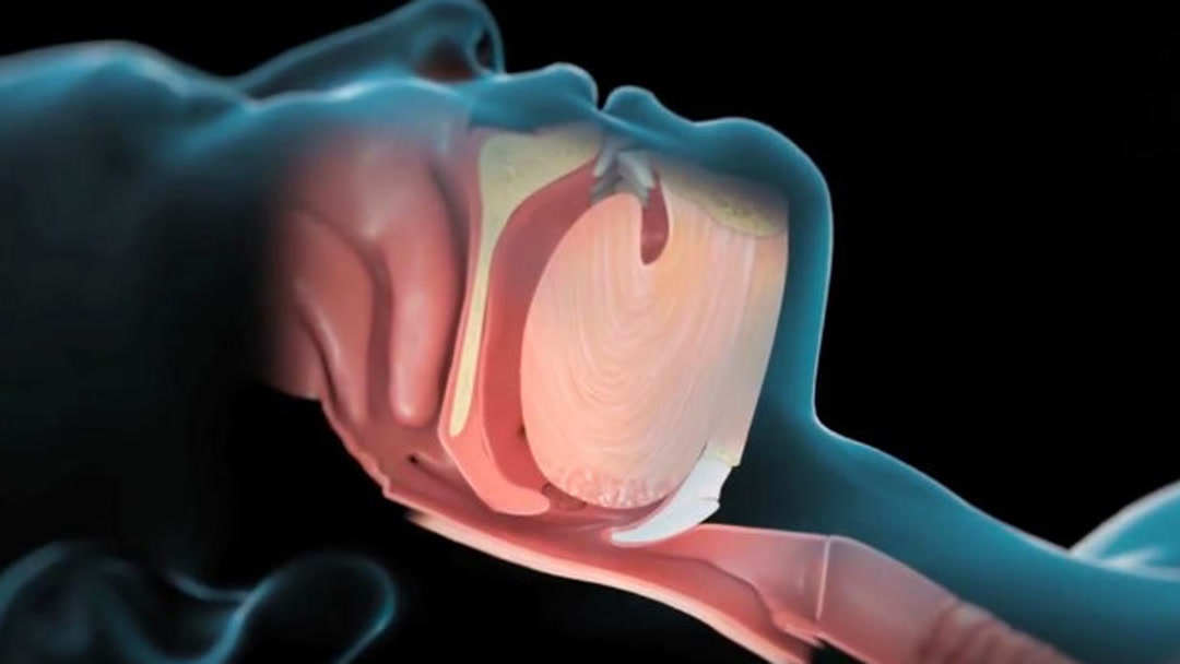 3D揭秘人为何会打鼾?