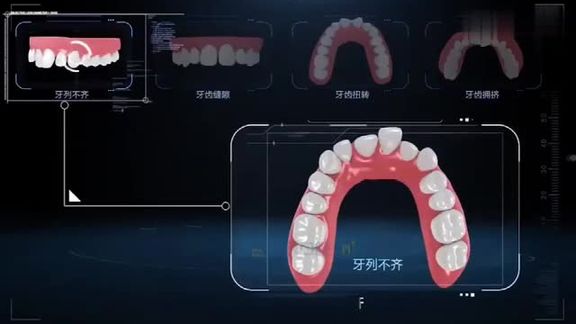 正畸过程#牙齿#